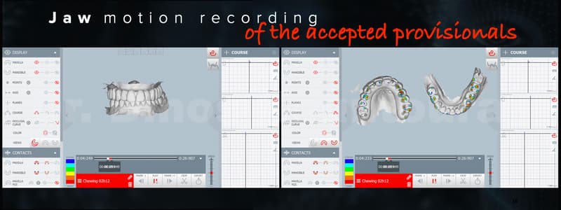 Digital Workflow Journey With Facially Generated Full Mouth Rehabilitation